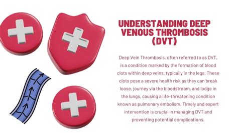 Ppt Deep Vein Thrombosis Surgeon At Encino Vascular Institute Expert