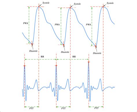 Feature Systole Diastole Pwa And Ptt Extraction From