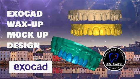 Exocad Wax Up Mock Up Youtube