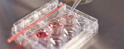 细胞培养基是生物医药行业发展的基石！国产培养及市场将有巨大空间！！ 细胞培养基是 生物医药 行业发展的基石，广泛应用于生物制药研发和生产各个