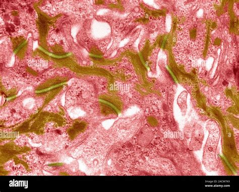 Skin Cell Desmosomes Coloured Transmission Electron Micrograph Tem