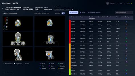 Art1 By Seetreat Objective Decision Support For Radiotherapy