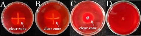 Frontiers Isolation And Identification Of Pathogens Of Morchella