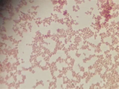 Microbiology Mania Endospore And Capsule Staining Lab May