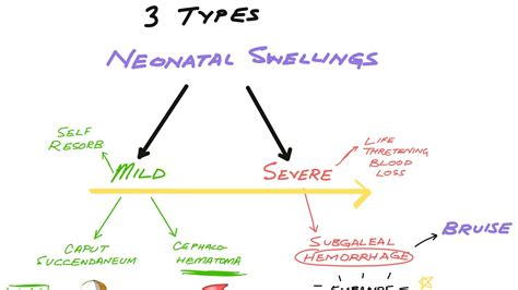Deep Learn Neonatal Scalp Swelling Usmle Step 2ck Youtube