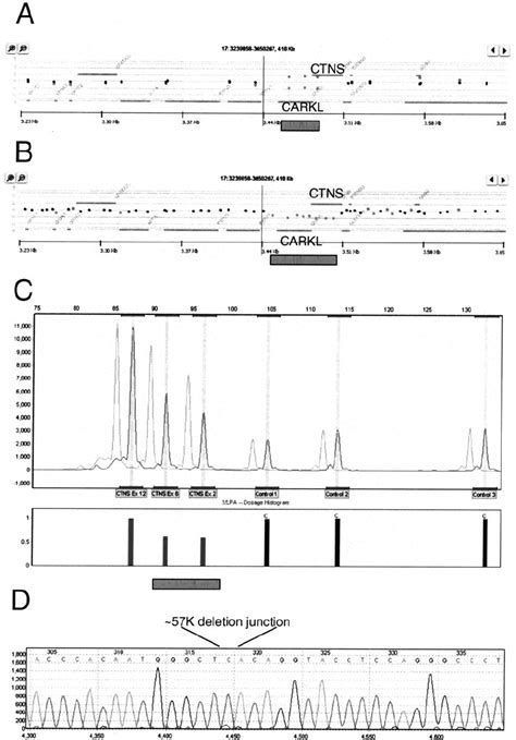 Oligonucleotide Array Cgh Detection Of A Heterozygous Genomic Deletion Download Scientific