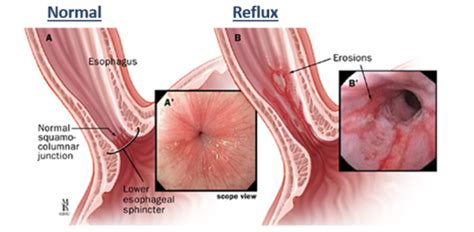 Anatomy Swallowing Flashcards Quizlet