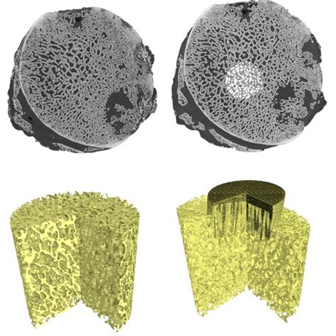 Micro Ct 3d Reconstruction Of Femoral Head Bone Samples A Before And