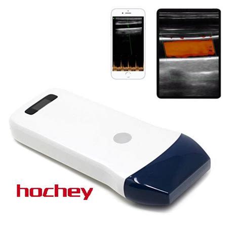 Ultrasound Scanning Probe 3 In One Color Doppler Wireless Probe Type Scanner Ultrasound Scanner