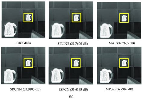 A And B Are Comparison Of Reconstruction Effects Of Different
