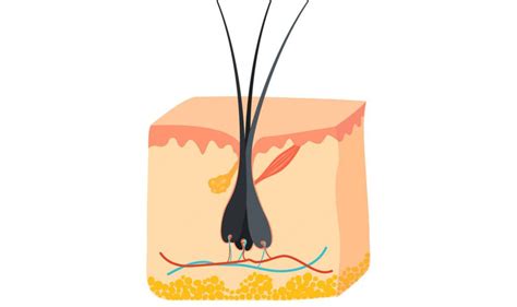 Why Are Two Hairs In One Follicle Causes Removal Methods And Faqs