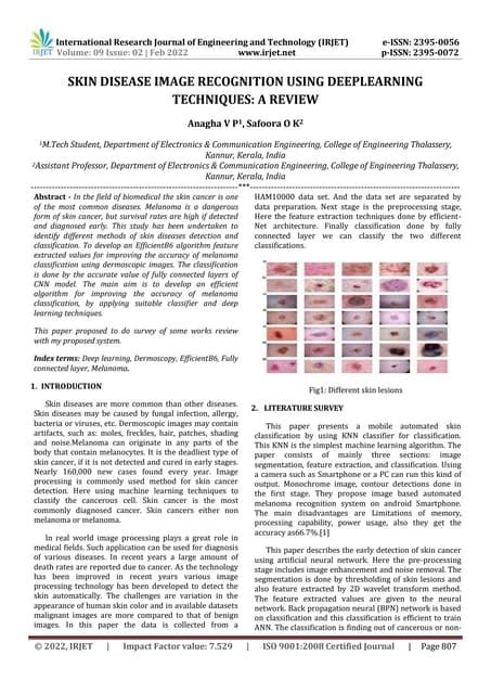 skin disease image recognition using deeplearning techniques a review