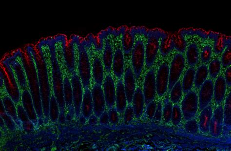 Pe Anti Human Cd167a Ddr1 Antibody Anti Cd167a 51d6