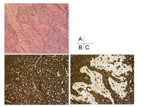 1a Formalin Fixed Paraffin Embedded Samples Were Stained With H And E