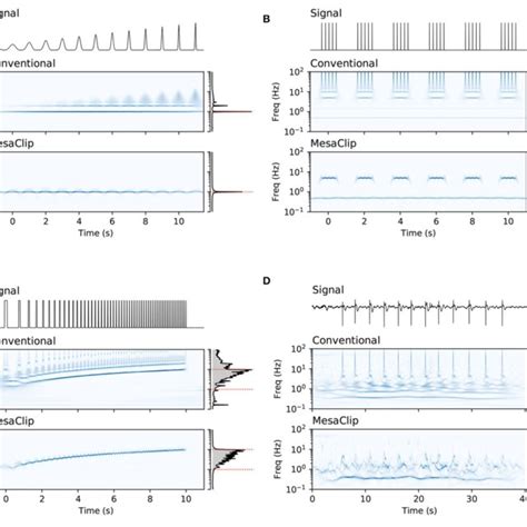 The Performance Of Different Noise Reduction Methods Normal Ecg