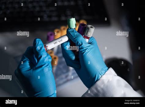 Blood Tests To Detect Sexually Transmitted Diseases Or STDs Hepatitis B And C Syphilis HIV