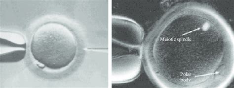 Meiotic Spindle And Polar Body In Human Oocytes Imaged With The Light