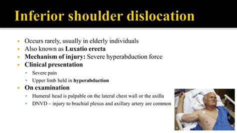 Shoulder Dislocation Types Clinical Features Pptx