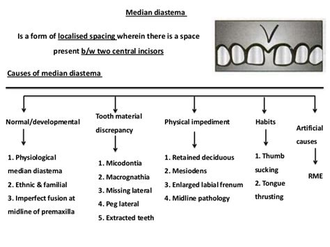 Etiology Of Malocclusion Ppt Download For Mac Powerupscoop
