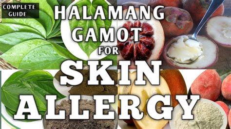 Top 10 Halamang Gamot Para Sa Skin Allergy Natural Remedies For Skin
