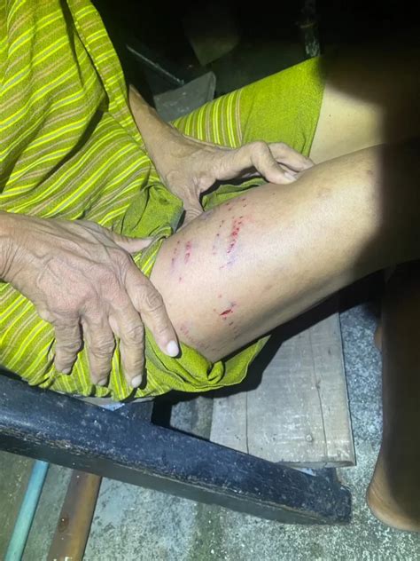 64 Year Old Woman Survives Terrifying Python Attack In Thailand