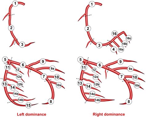 Prediction Of Coronary Risk By Syntax And Derived Scores Synergy Between Percutaneous Coronary