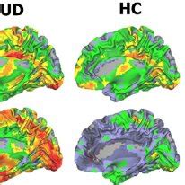 Surface Rendering Showing The Distribution Of Short Range And Download Scientific Diagram