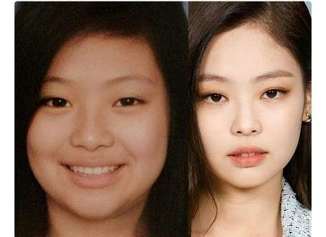 Kim Tae Hee Plastic Surgery Before After Artofit