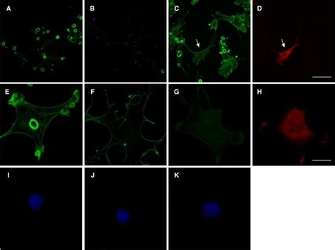 Inhibition Of Rho Disrupts F Actin In Src Transformed Fibroblasts
