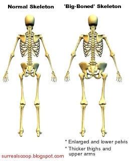 First “big Boned” Skeleton Discovered By Surrealscoop Medium