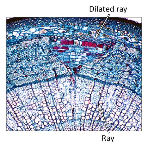 Parenchyma Cell
