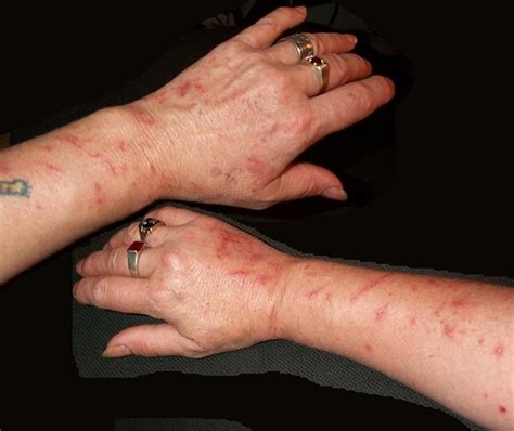 Wild Parsnip Avoid This Dangerous Invasive Species Greenough