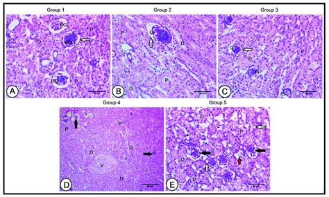 A Histopathological Analysis Of The Renal Cortex In The Experimental