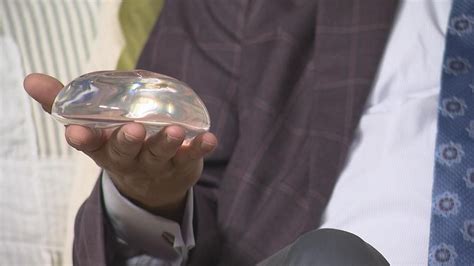 Breast Implants Linked To Cancer Recalled Columbus Doctor Says Women
