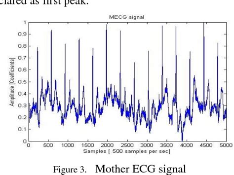 Figure 3 From Fetal Ecg Extraction Using Wavelet Transform Semantic Scholar