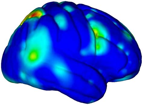 3 Correlation Maps Between Specic Reference Points And Other Brain