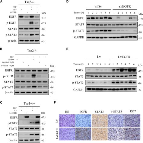 Runx1 Egfr Pathway Contributes To Stat3 Activation And Tumor Growth Caused By Hyperactivated