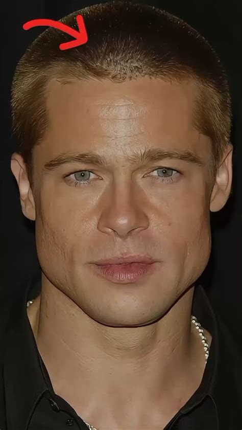 Balding Crown Buzz Cut