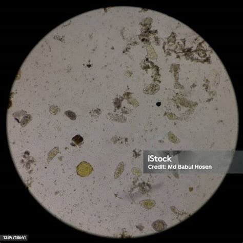 Vegetable Cell Of Stool Analysis Under Microscope Fecul Vegetable Cell