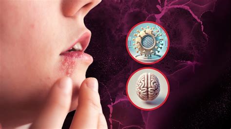 Científicos Muestran Cómo El Herpes Daña El Cerebro Y Altera El
