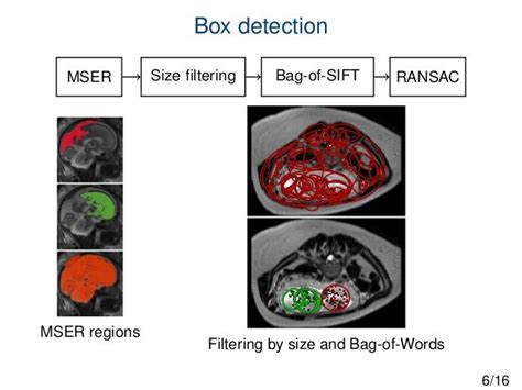 Automated Fetal Brain Segmentation From 2d Mri Slices For Motion Corr…