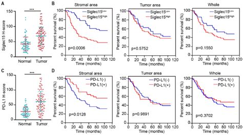 Prognostic Significance Of Siglec15 And Pd L1 Expression On Prognosis Download Scientific