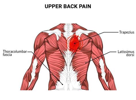 upper spine problems