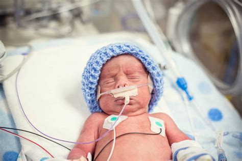 3600 Unidad De Cuidados Intensivos Neonatales Fotografías De Stock