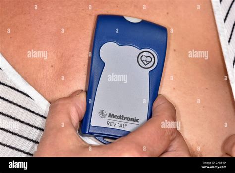 Insertable Heart Monitor Close Up Of A 55 Year Old Female Patient Using A Hand Held Insertable