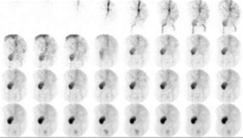 NUCS GU Flashcards Quizlet