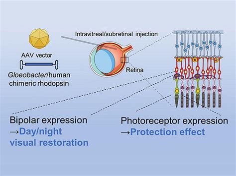 Optogenetics Used To Aim For Vision Regeneration In Intractable Eye Disease First Clinical