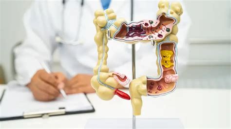 Loop Ileostomy Closure Cpt Code