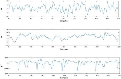 exemplary typical eeg signals of the sets class z o class n f