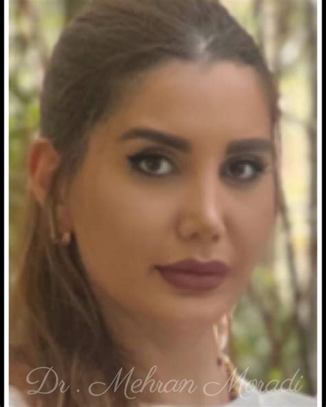 ‎drmehran Moradi دكتر مهران مرادى‎ ‎ يك سال بعد از عمل
